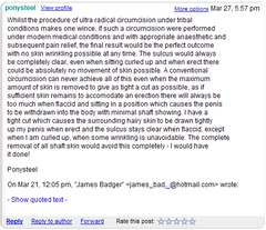 Circlist - IntactiWiki